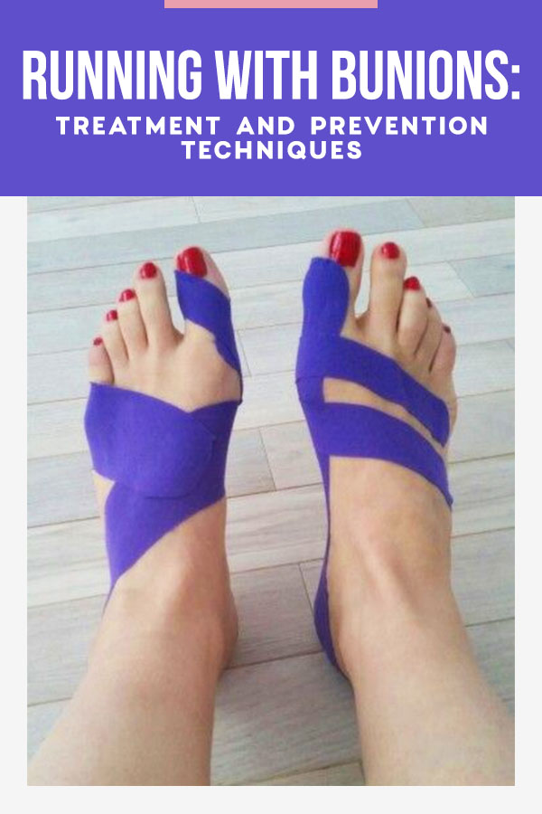 Running with Bunions: 11 Treatment and Prevention Techniques