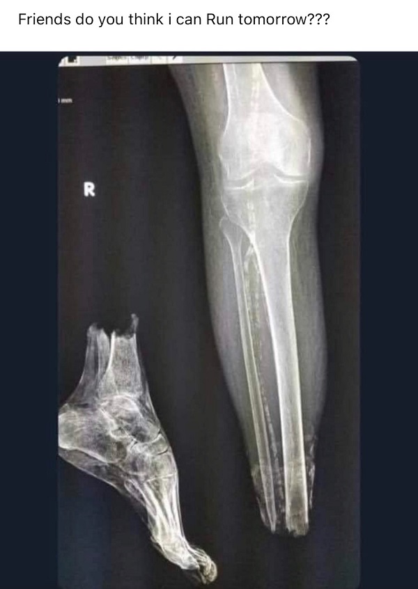 17 Funniest Running Memes - Which One's Do You Relate To?