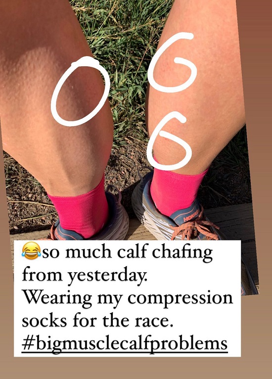 5 Easy Ways to Avoid Chafing + Best Chafing Creams (2025)